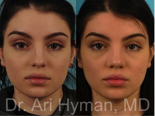 ARI HYMAN, MD - Updated October 2024 - 388 Photos & 57 Reviews - 16311 ...