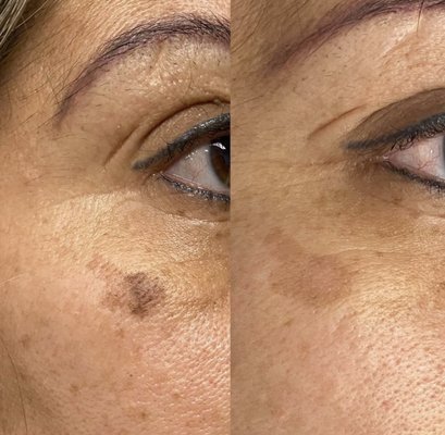 DERMALASER MED SPA - Updated January 2025 - 70 Photos & 27 Reviews ...