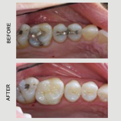 L. ANDREW MUTCH, DDS - Updated January 2026 - 22 Photos & 108 Reviews ...