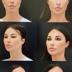 MARC MANI, MD - 13 Reviews - 9675 Brighton Way, Beverly Hills ...