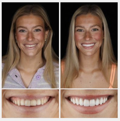 SMILE TEXAS - Updated December 2025 - 21 Photos & 15 Reviews - 4665 ...