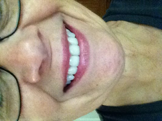 TOOTH BY SUNNY BADYAL, DDS - Updated December 2025 - 21 Photos & 85 ...