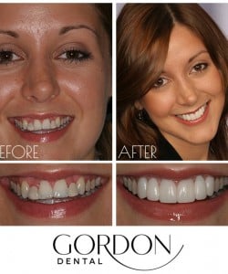 GORDON DENTAL IMPLANTS AND COSMETICS - Updated June 2026 - 33 Photos ...