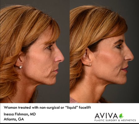 AVIVA PLASTIC SURGERY & AESTHETICS - Updated May 2024 - 456 Photos & 10 ...
