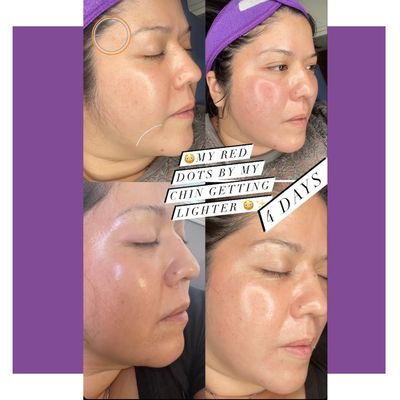 UNBLEMISHED SKIN STUDIO - Updated October 2025 - 100 Photos & 14 ...
