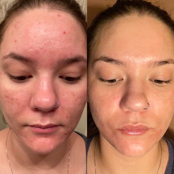 SHAHIN JAVAHERI, MD - Updated July 2025 - 37 Photos & 33 Reviews - 2999 ...