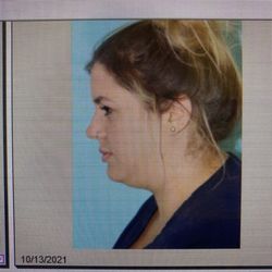 JEFFREY RAWNSLEY, MD - RAWNSLEY PLASTIC SURGERY - 61 Photos & 67 ...