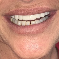 BIONIC SMILE - 25 Photos - Las Vegas, Nevada - Cosmetic Dentists ...
