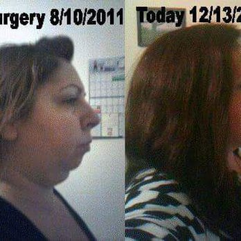 DALE E STRINGER, DDS - Updated May 2024 - 17 Reviews - 6860 Brockton Ave, Riverside, California ...