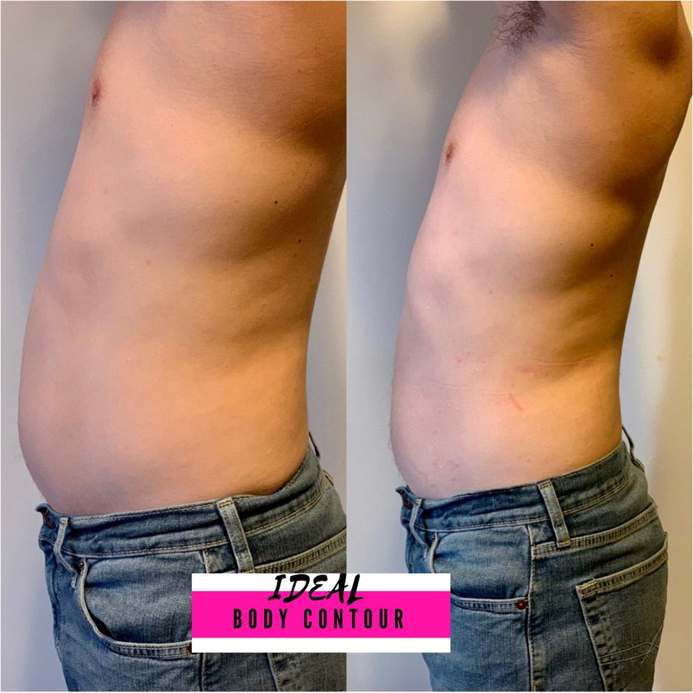 IDEAL BODY CONTOUR - Updated November 2024 - 11 Bond Street, St ...