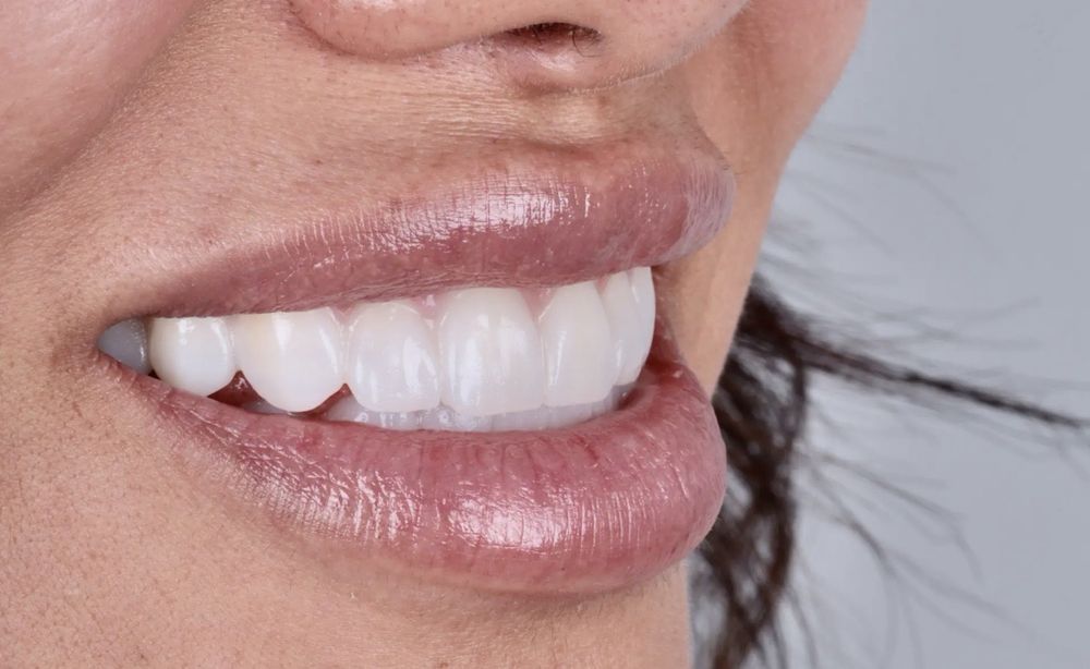 MIAMI PERFECT SMILE - Updated May 2026 - 12 Photos - 4995 NW 72nd Ave ...