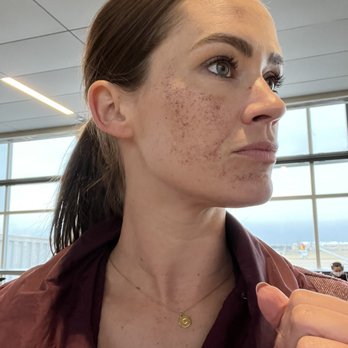 GLO MED SPA AUSTIN - Updated October 2025 - 101 Photos & 47 Reviews - 9801 Anderson Mill Rd ...