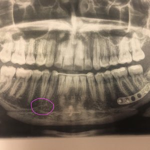 INTERFACE CENTRE FOR ORAL AND MAXILLOFACIAL SURGERY - Updated January ...
