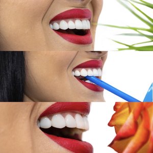 DENTAL DESIGN SMILE - Updated May 2024 - 38 Photos & 32 Reviews - 11980 ...