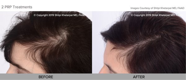 TODD E. PERKINS, MD - 61 Photos & 214 Reviews - 900 17th St NW ...