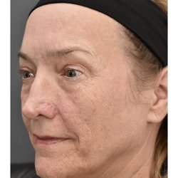 DONALD B YOO, MD, FACS - 374 Photos & 161 Reviews - Cosmetic Surgeons ...