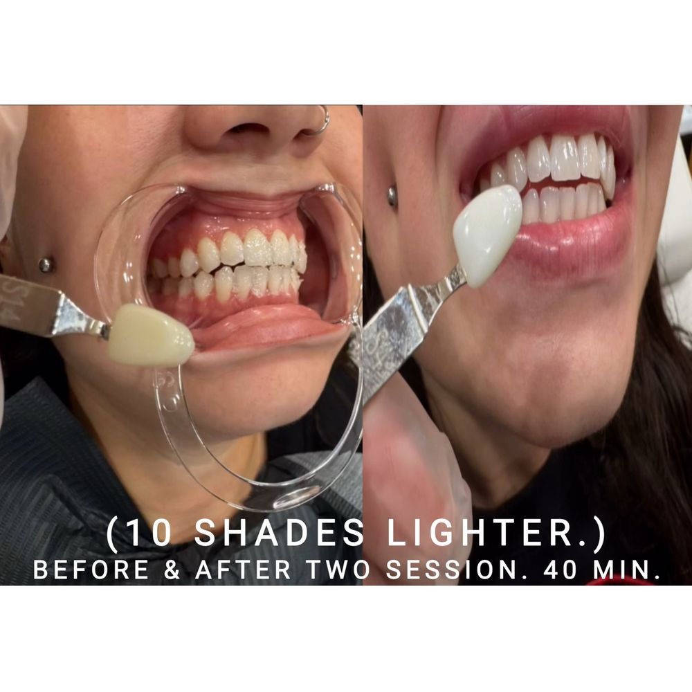 THE TOOTH PLUG - Updated June 2025 - Request an Appointment - Yuba City ...