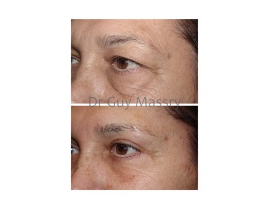 GUY MASSRY, MD - Updated December 2025 - 154 Photos & 176 Reviews - 150 ...