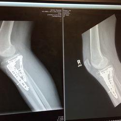 JUSTIN CHRONISTER, MD - 62 Photos - 1431 Studemont St, Houston, TX - Yelp