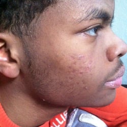 MITCHELL DERMATOLOGY - 17 Photos - 815 Commerce Dr, Perrysburg, Ohio ...