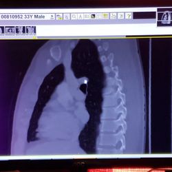 PETER STRUTZ, MD - 16 Reviews - Family Practice - 605 E Alvarado St ...