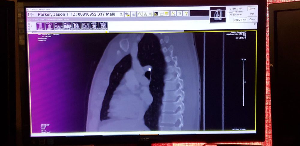 PETER STRUTZ, MD - Updated October 2025 - 27 Reviews - 605 E Alvarado ...