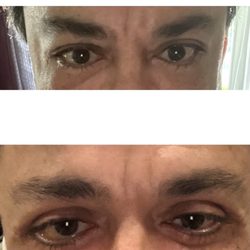 GUY MASSRY, MD - 122 Photos & 101 Reviews - Cosmetic Surgeons - 150 N ...