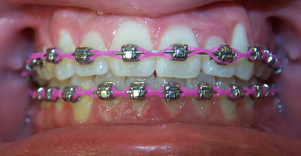 RALPH A CALLENDER, DDS - Updated October 2025 - 11 Photos - 3701 ...