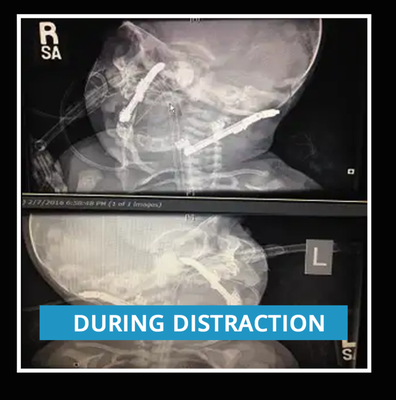 NICHOLAS BASTIDAS, MD - Updated December 2025 - 715 Park Ave, New York ...