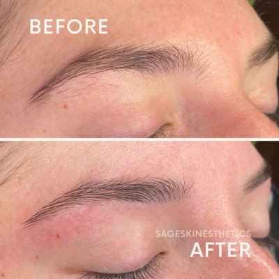SAGE SKIN ESTHETICS - Updated January 2025 - 37 Photos - 1298 Minnesota ...