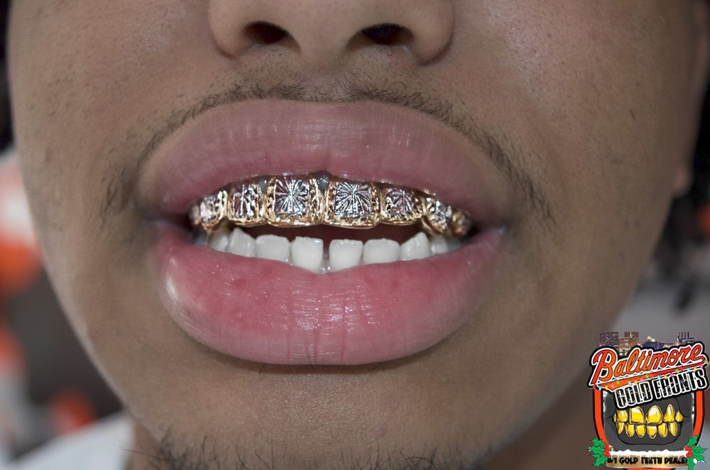 BALTIMORE GOLD FRONTS - Updated June 2025 - 104 Photos - 110 N Eutaw St ...