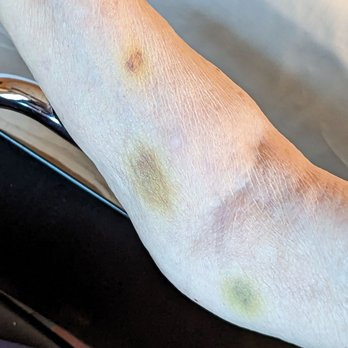 MJHS MENORAH CENTER FOR REHABILITATION AND NURSING CARE - Updated ...