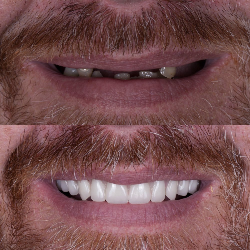 SAME DAY SMILES - Updated July 2024 - 1646 Westgate Cir, Brentwood ...