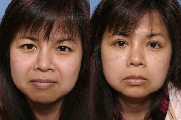 VIP PLASTIC SURGERY - Updated August 2025 - 112 Photos & 72 Reviews ...