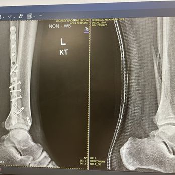 Eric Ferkel, MD - Serving Los Angeles, CA - Updated November 2025 - 6 ...