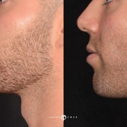 JASON EMER, MD - 995 Photos & 386 Reviews - 9201 Sunset Blvd, West ...