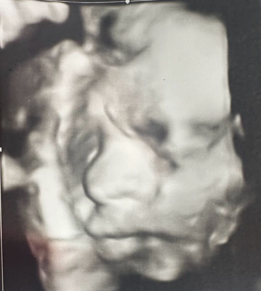 ULTRASONA FETAL FOTOS - Updated December 2025 - 27 Photos & 44 Reviews ...
