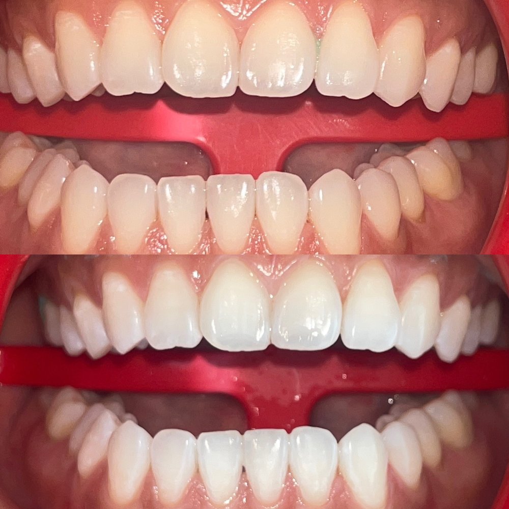 SOFI DENTAL CARE & ORTHODONTICS - Updated December 2025 - 16 Photos & 99 Reviews - 119 ...