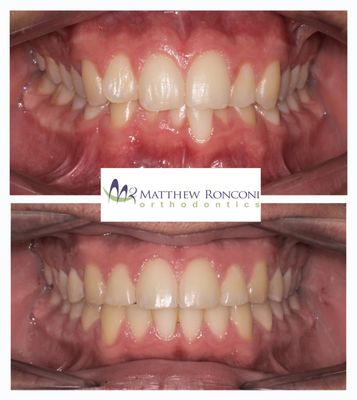 MATTHEW RONCONI ORTHODONTICS - Updated December 2025 - 29 Photos & 20 ...