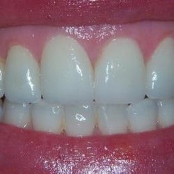 DAVID W HYTEN, DMD - 23 Photos - General Dentistry - 2110 Troy Rd ...