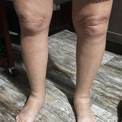 PURE PLASTIC SURGERY - 25 Photos & 26 Reviews - 7265 SW 93rd Ave, Miami ...