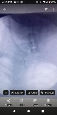 AKUMIN IMAGING - Updated July 2025 - 10 Photos & 67 Reviews - 2229 N ...