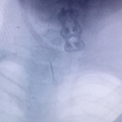 AKUMIN IMAGING - 38 Reviews - 2229 N Commerce Pkwy, Weston, Florida ...