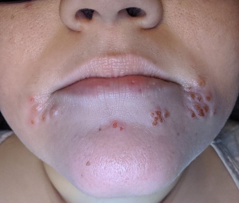 SAND DERMATOLOGY - Updated 2024 - 58 Photos & 166 Reviews - 3110 Chino ...