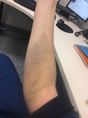 MACNEAL HOSPITAL - Updated September 2025 - 27 Photos & 123 Reviews ...