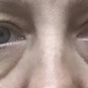 MICHAEL J GROTH, MD - 11 Photos & 30 Reviews - 9675 Brighton Way ...