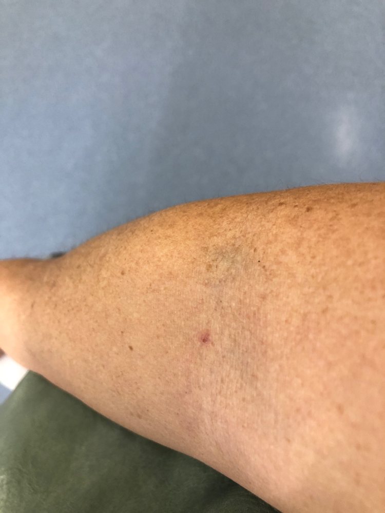 BIOLIFE PLASMA SERVICES - Updated January 2026 - 13 Photos & 64 Reviews ...