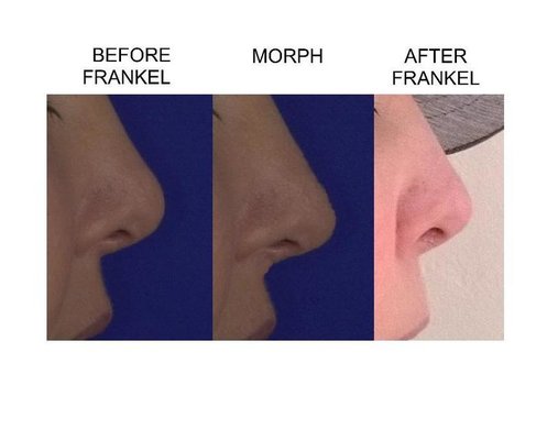 ANDREW S.FRANKEL,MD - Updated December 2025 - 35 Photos & 44 Reviews ...