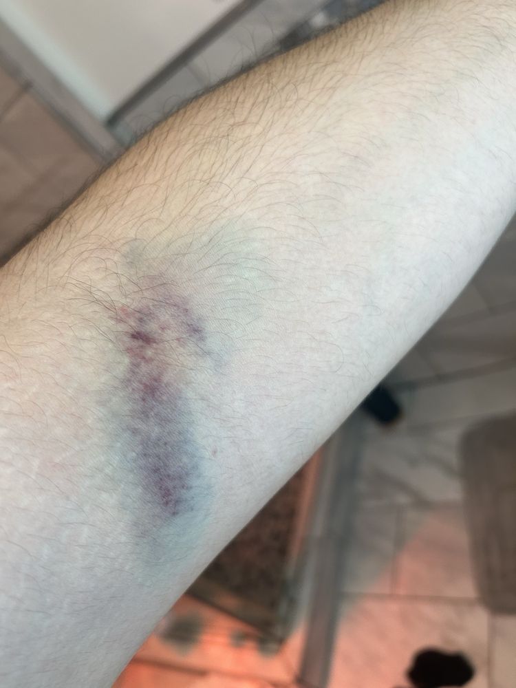 BIOLIFE PLASMA SERVICES - Updated October 2025 - 29 Photos & 59 Reviews ...