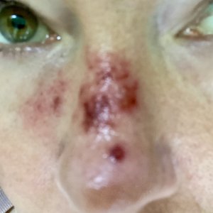 SUSAN LEU, MD, FAAD - Updated June 2025 - 1909 214th St SE, Bothell ...